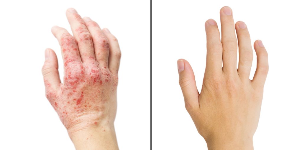 Medical Dermatology - I.A. Tangoren MD, P.L.L.C.