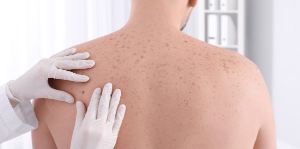 Medical Dermatology - I.A. Tangoren MD, P.L.L.C.